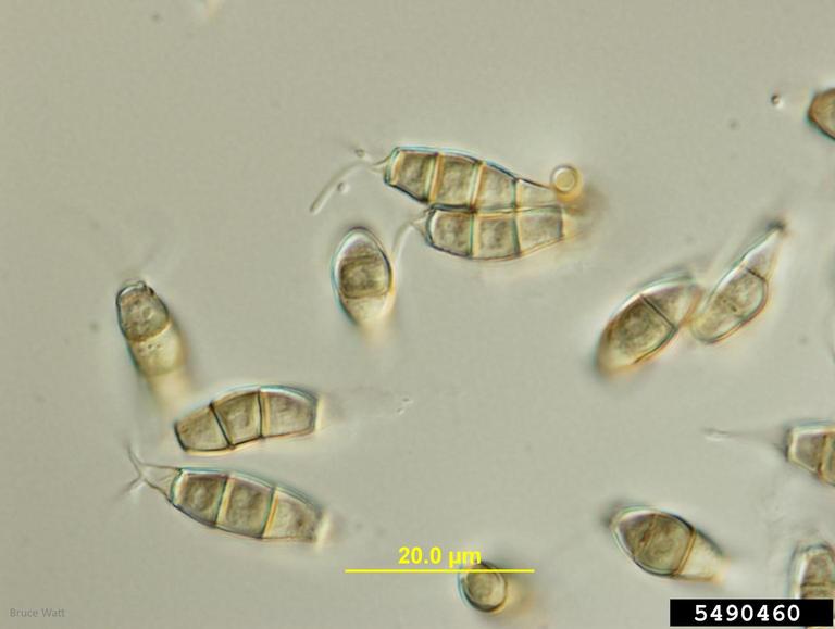 Pestalotiopsis leaf spot (Genus Pestalotiopsis R. L. Steyaert)