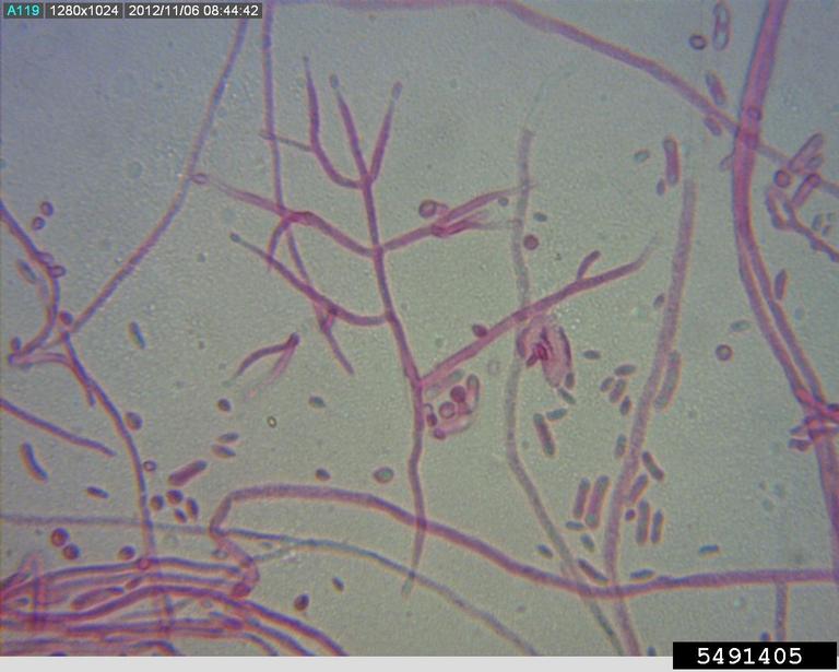 Verticillium wilts (Genus Verticillium Nees.)