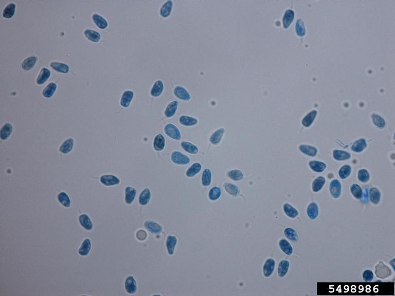Phyllosticta leaf spot (Phyllosticta citricarpa (McAlpine) Aa, 1973)