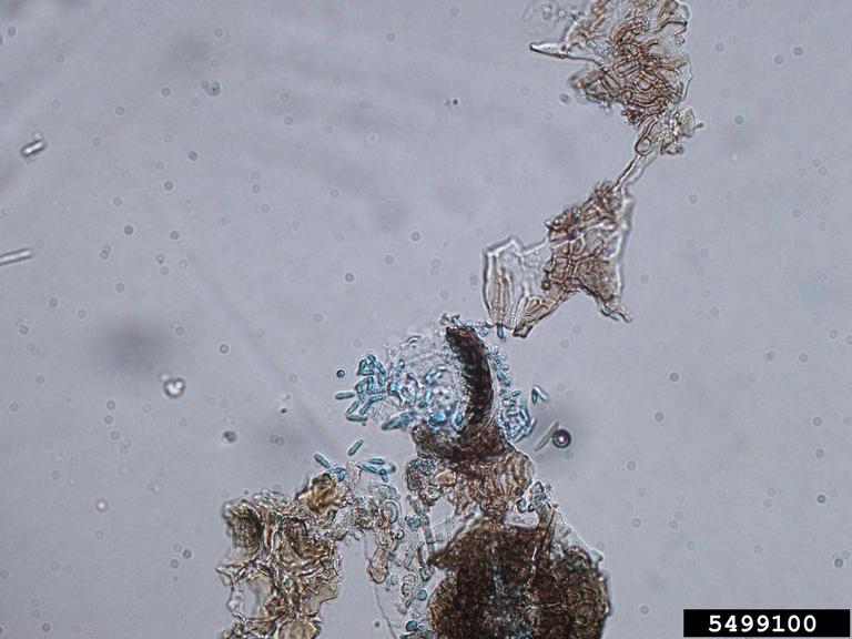 Mycosphaerella fungi (Genus Mycosphaerella Johanson)