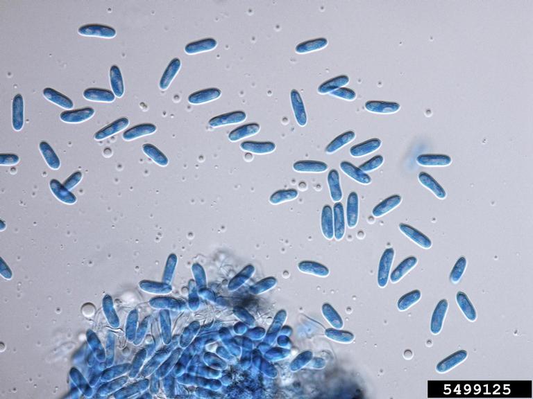 bitter rot and anthracnose (Colletotrichum gloeosporioides (Penz.) Penz ...