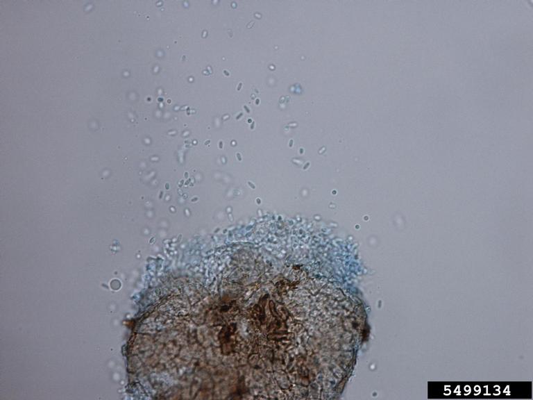 Phoma blights (Genus Phoma Sacc.)