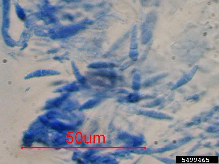 Phaeosphaeria fungi (Genus Phaeosphaeria I. Miyake)