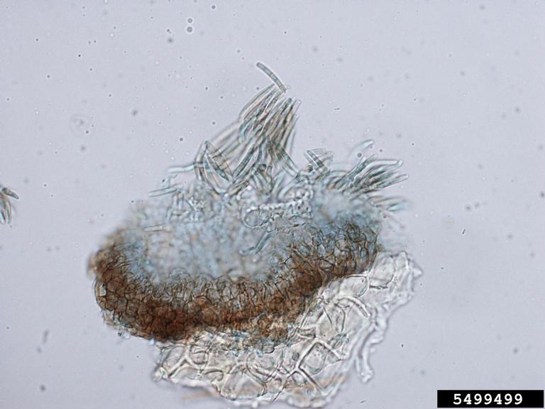 Phaeosphaeria fungi (Genus Phaeoseptoria Speg.)