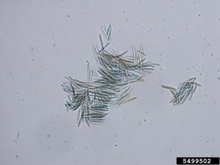 Phaeosphaeria fungi (Genus Phaeoseptoria Speg.)