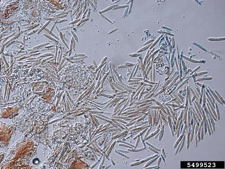 leaf blotch (Genus Stagonospora (Sacc.) Sacc.)