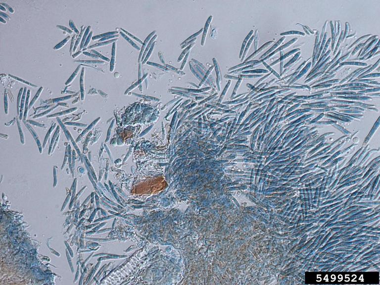 leaf blotch (Genus Stagonospora (Sacc.) Sacc.)