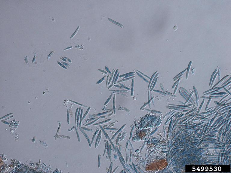 leaf blotch (Genus Stagonospora (Sacc.) Sacc.)