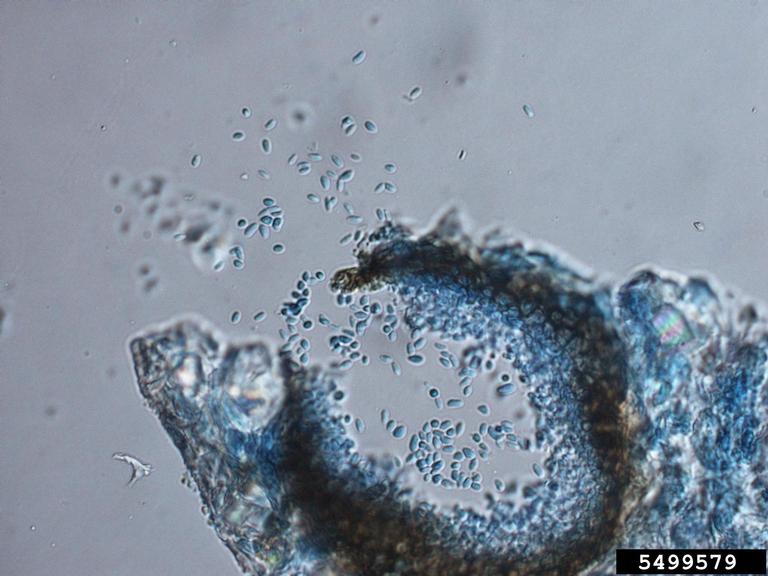 Phoma blights (Genus Phoma Sacc.)