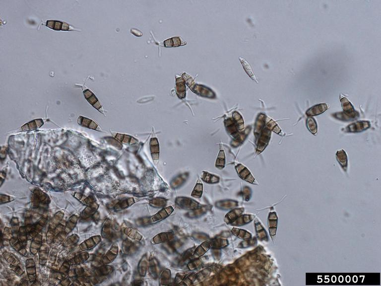 Pestalotiopsis leaf spot (Genus Pestalotiopsis R. L. Steyaert)