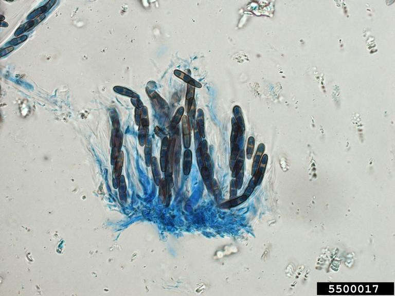 Zasmidium citrigriseum (F.E. Fisher) U. Braun & Crous 2014