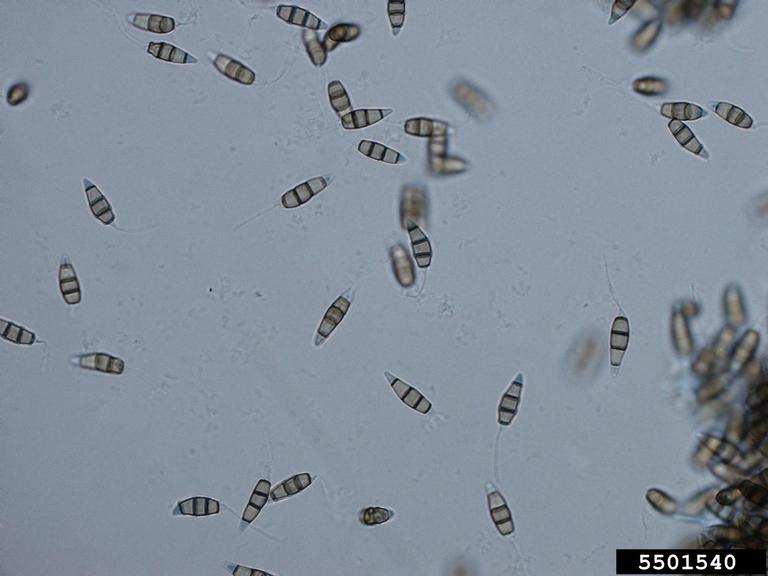 Pestalotiopsis blight (Pestalotiopsis guepinii)