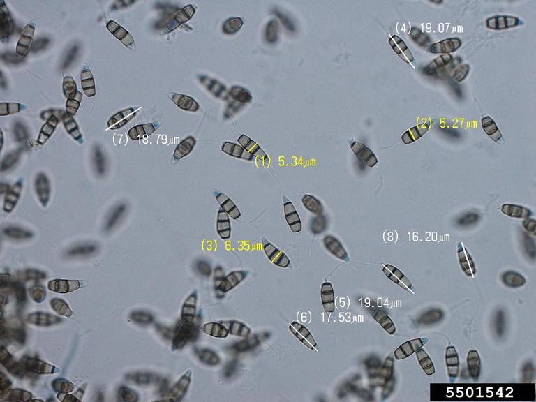 Pestalotiopsis blight (Pestalotiopsis guepinii)