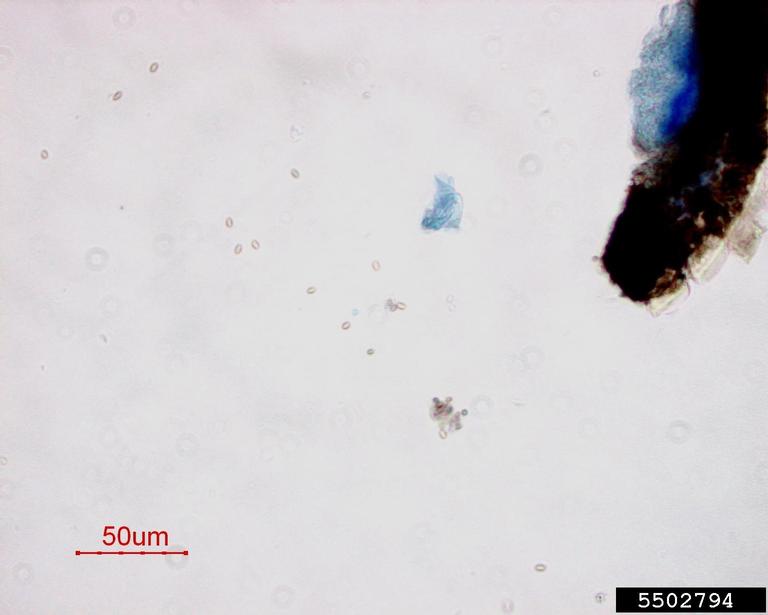 fungus (Genus Microsphaeropsis Höhn., 1917)