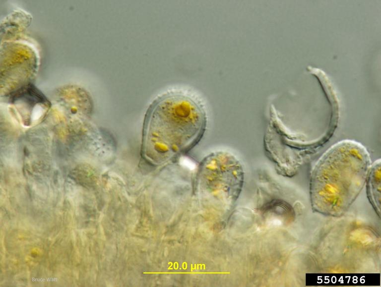 Puccinia psidii G. Winter (Synonym for Austropuccinia psidii)
