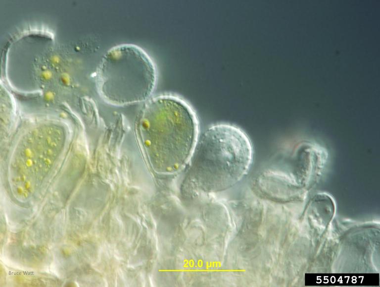myrtle rust (Austropuccinia psidii)