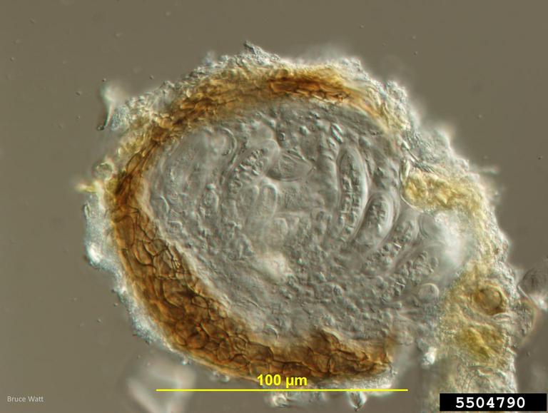 Ascochyta blight of pea (Didymella pinodes (Berk. & A. Bloxam) Petr. 1924)