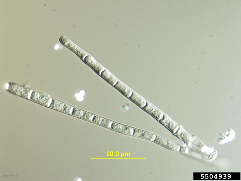 Cercospora leaf spot (Cercospora beticola Sacc.)
