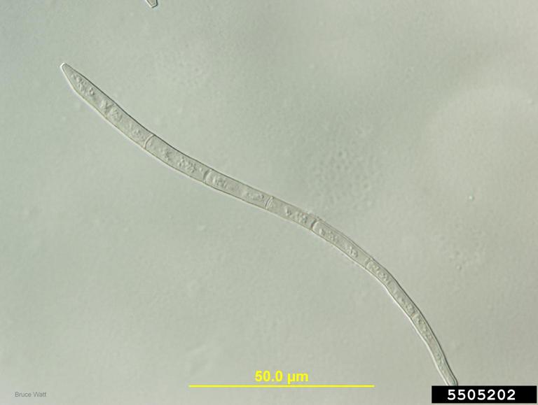 Cercospora fungi (Genus Cercospora Fresen.)
