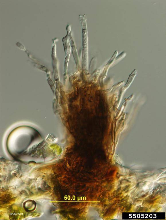 Cercospora fungi (Genus Cercospora Fresen.)