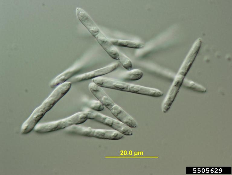 strawberry leaf spot (Ramularia grevilleana Verkley & U. Braun)