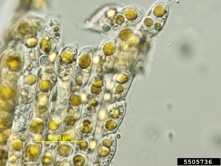 Chrysomyxa weirii H.S. Jacks. (Synonym for Ceropsora weirii (H.S. Jacks ...