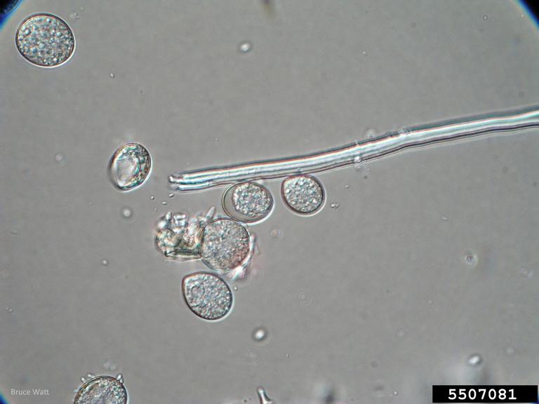 downy mildew (Peronospora manshurica)