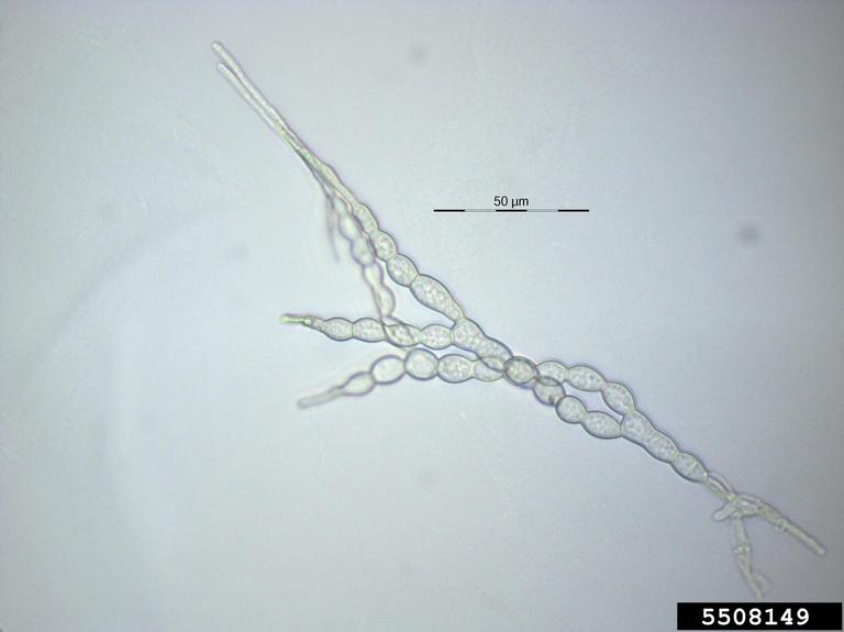 brown rot (Monilinia fructicola (G. Wint.) Honey)
