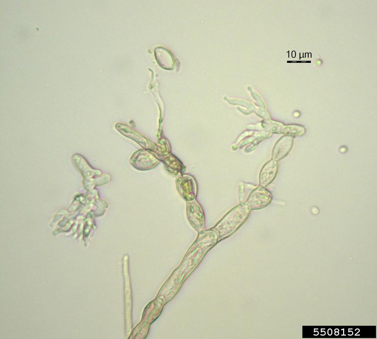 brown rot (Monilinia fructicola)