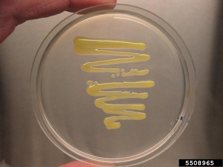 bacterial spot (Genus Xanthomonas)