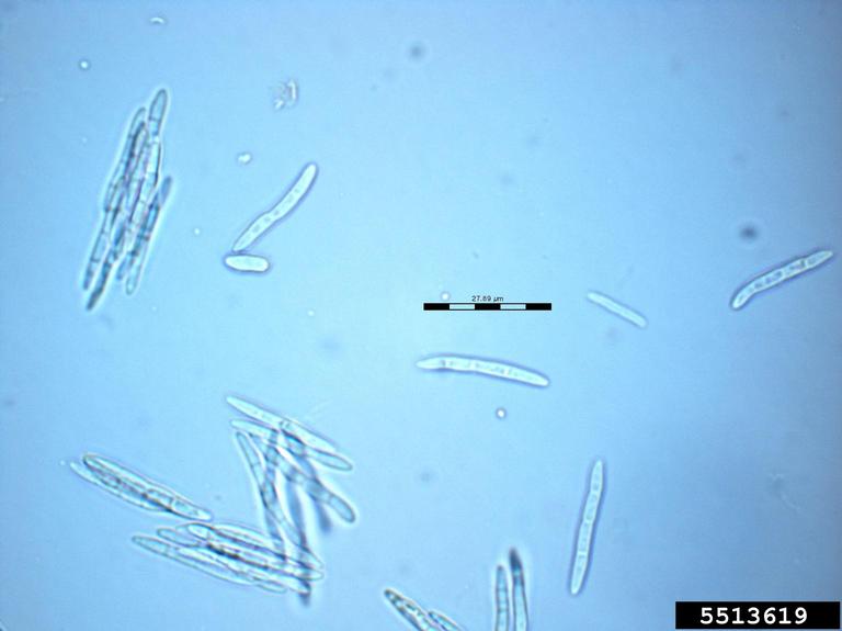 Dothistroma needle blight (Mycosphaerella pini)