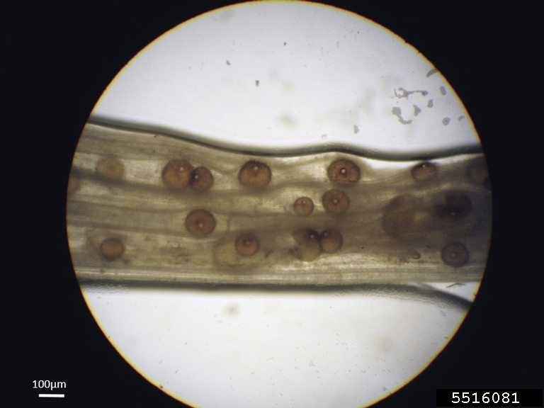 Ascochyta fungi (Genus Ascochyta)