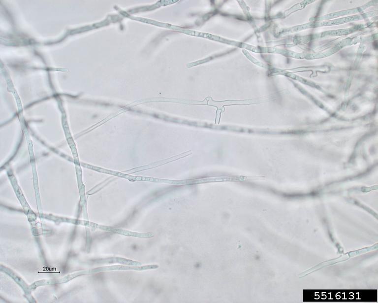 inky cap (Genus Coprinus)