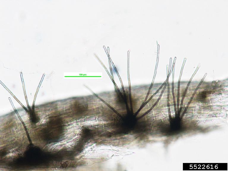 Cercospora blight (Cercospora kikuchii (Mastsumoto & Tomoyasu) M.W ...
