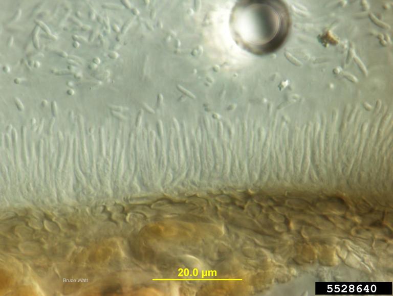 Cytospora cankers (Genus Cytospora Ehrenb.)