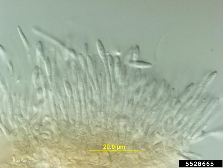 Phomopsis cankers and twig blights (Genus Phomopsis)