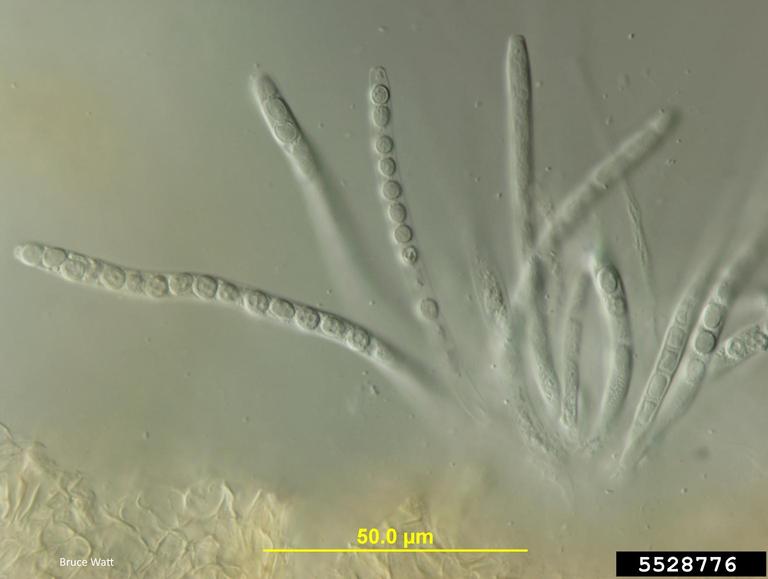 Hypocrea (Hypocrea citrina)