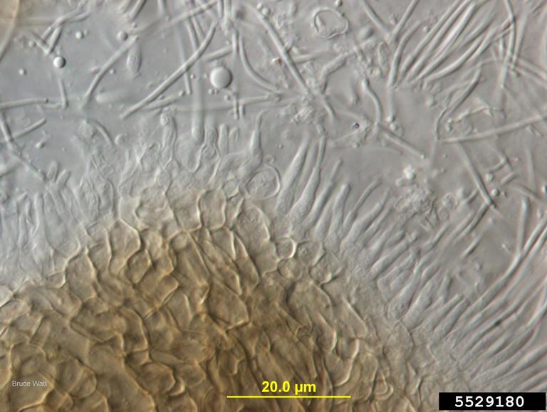 Phomopsis cankers and twig blights (Genus Phomopsis (Sacc.) Bubák)