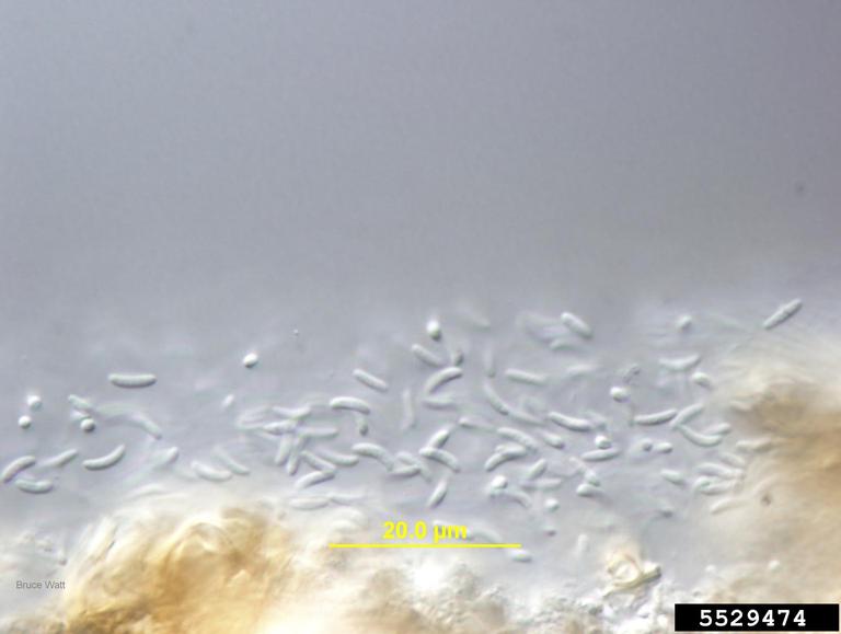 Cytospora cankers (Genus Cytospora Ehrenb.)