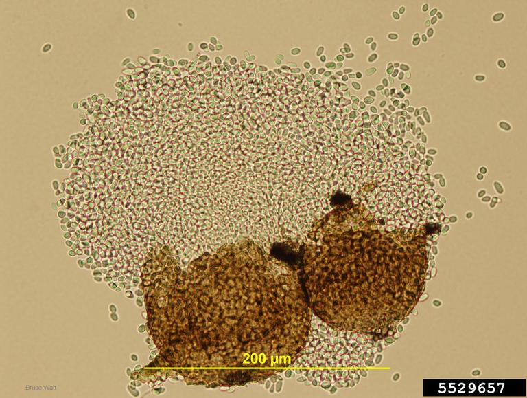 Rhizosphaera needle cast (Rhizosphaera kalkhoffii)