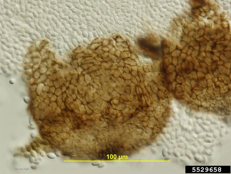 Rhizosphaera needle cast (Rhizosphaera kalkhoffii)