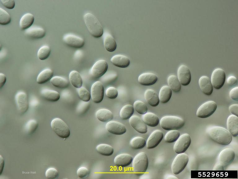 Rhizosphaera needle cast (Rhizosphaera kalkhoffii)