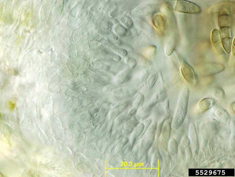 leaf blotch (Genus Stagonospora (Sacc.) Sacc.)