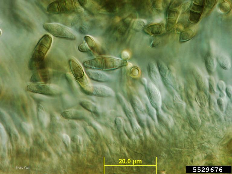 leaf blotch (Genus Stagonospora (Sacc.) Sacc.)