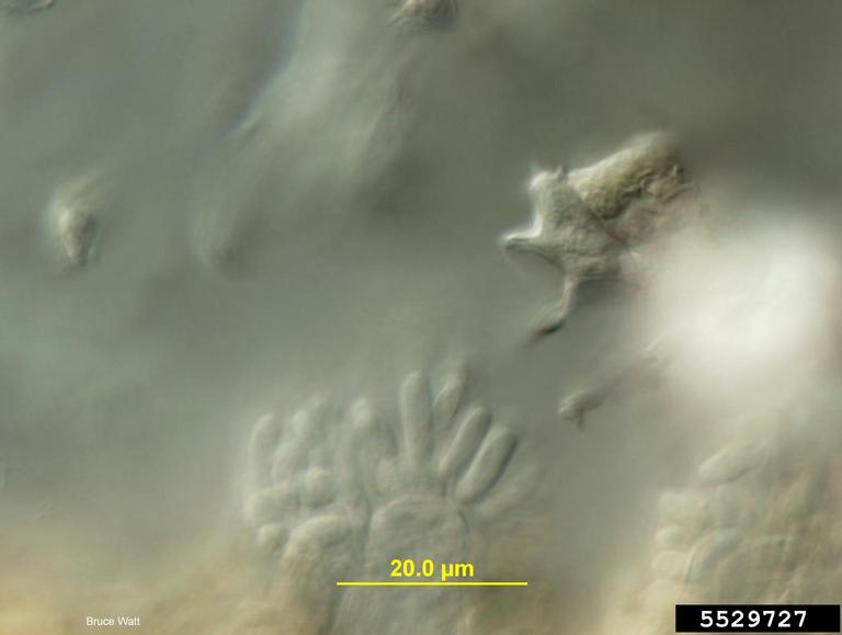 anthracnose (Aureobasidium apocryptum (Ellis & Everh.) Herm.-Nijh.)