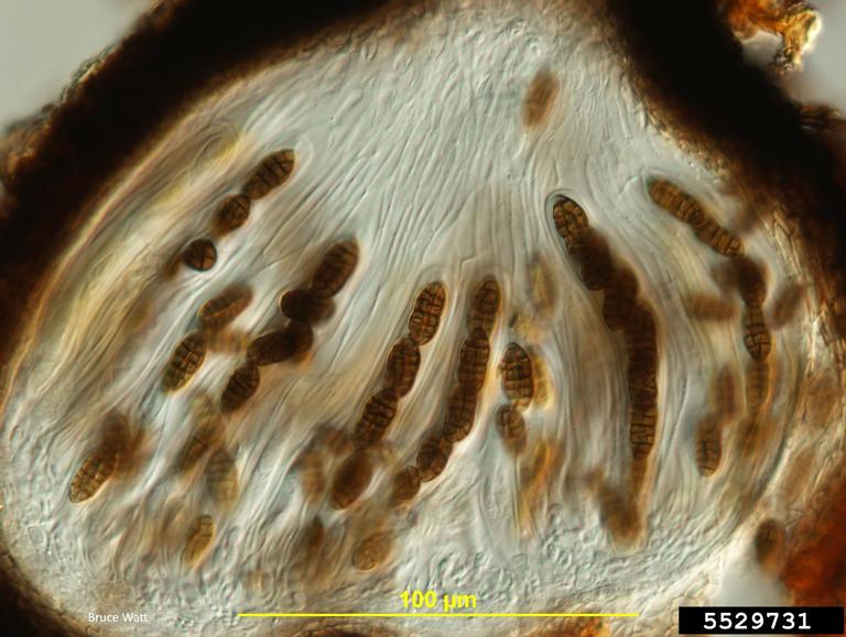 ascomycete fungi (Genus Pleospora Rabenh. ex Ces. & De Not.)