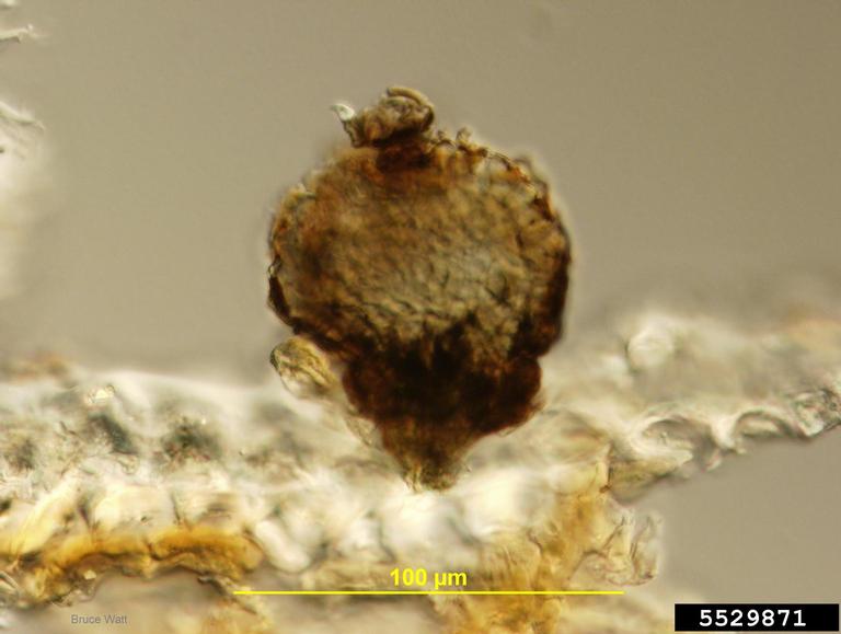 Rhizosphaera needle cast (Rhizosphaera pini (Corda) Maubl.)
