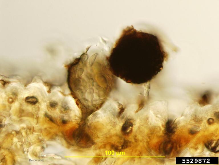 Rhizosphaera needle cast (Rhizosphaera pini)