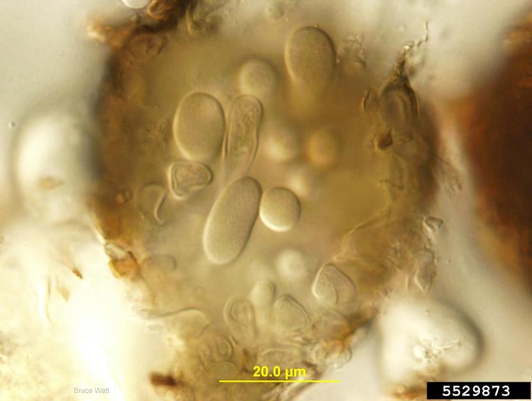 Rhizosphaera needle cast (Rhizosphaera pini)