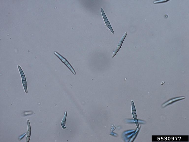 Paraleptosphaeria macrospora